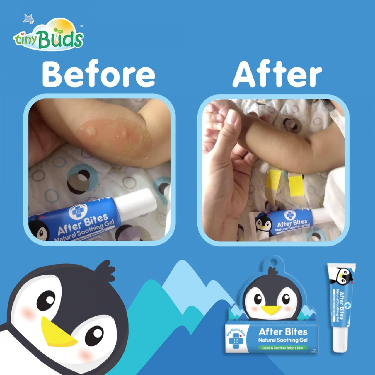 Tiny Remedies After Bites Natural Soothing Gel 20g